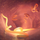 All About Pinworms: Symptoms, Treatments, and Prevention - Dr. Green Mom