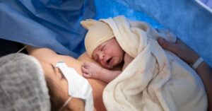 What is a Gentle Cesarean? - Dr. Green Mom