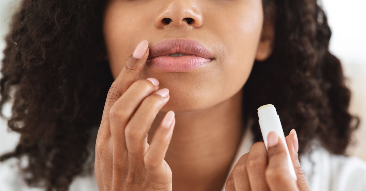 Managing Cold Sore Flares in Adults - Dr. Green Mom